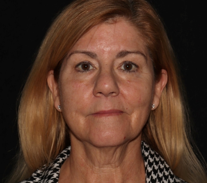 Enhance Your Practice with Sofwave™