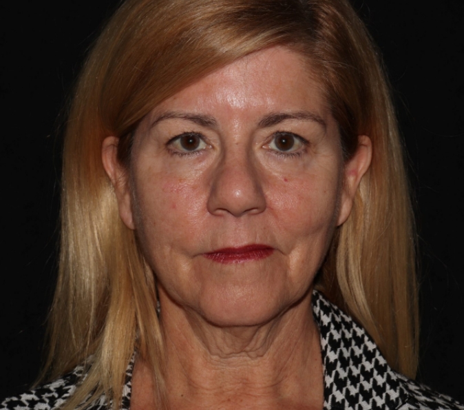 Enhance Your Practice with Sofwave™