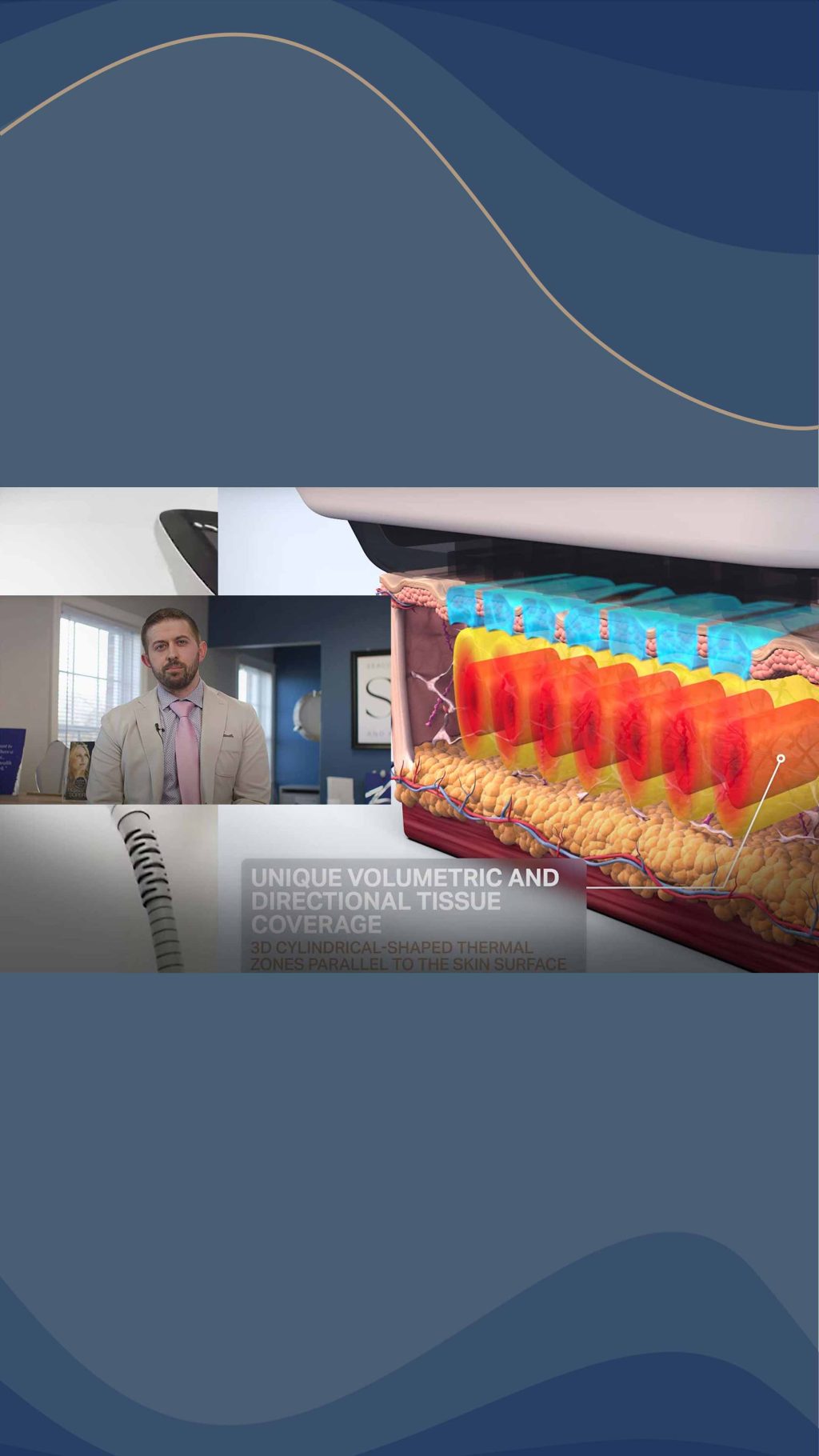 Sofwave™ SUPERB™ Technology