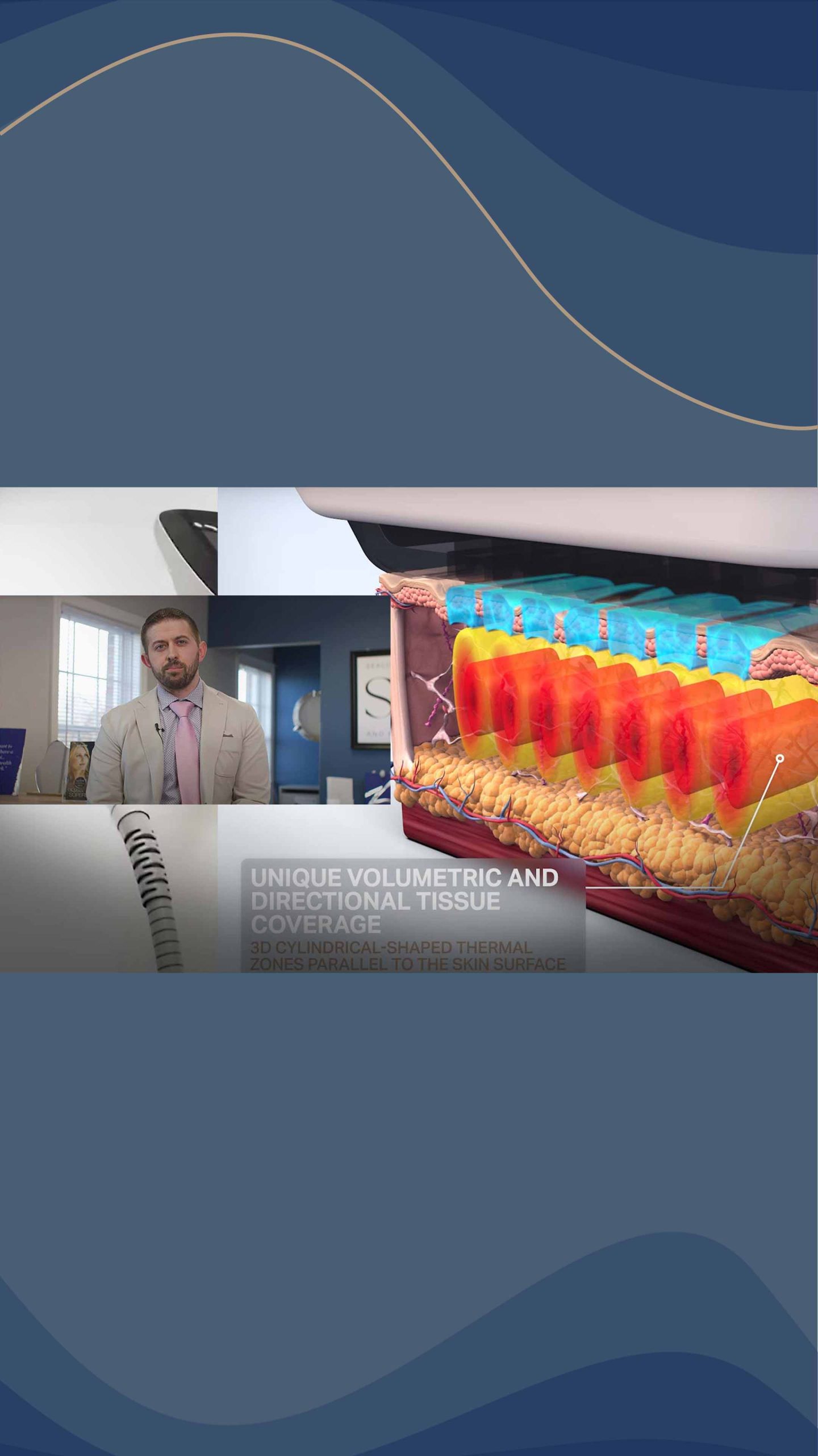 Sofwave™ SUPERB™ Technology