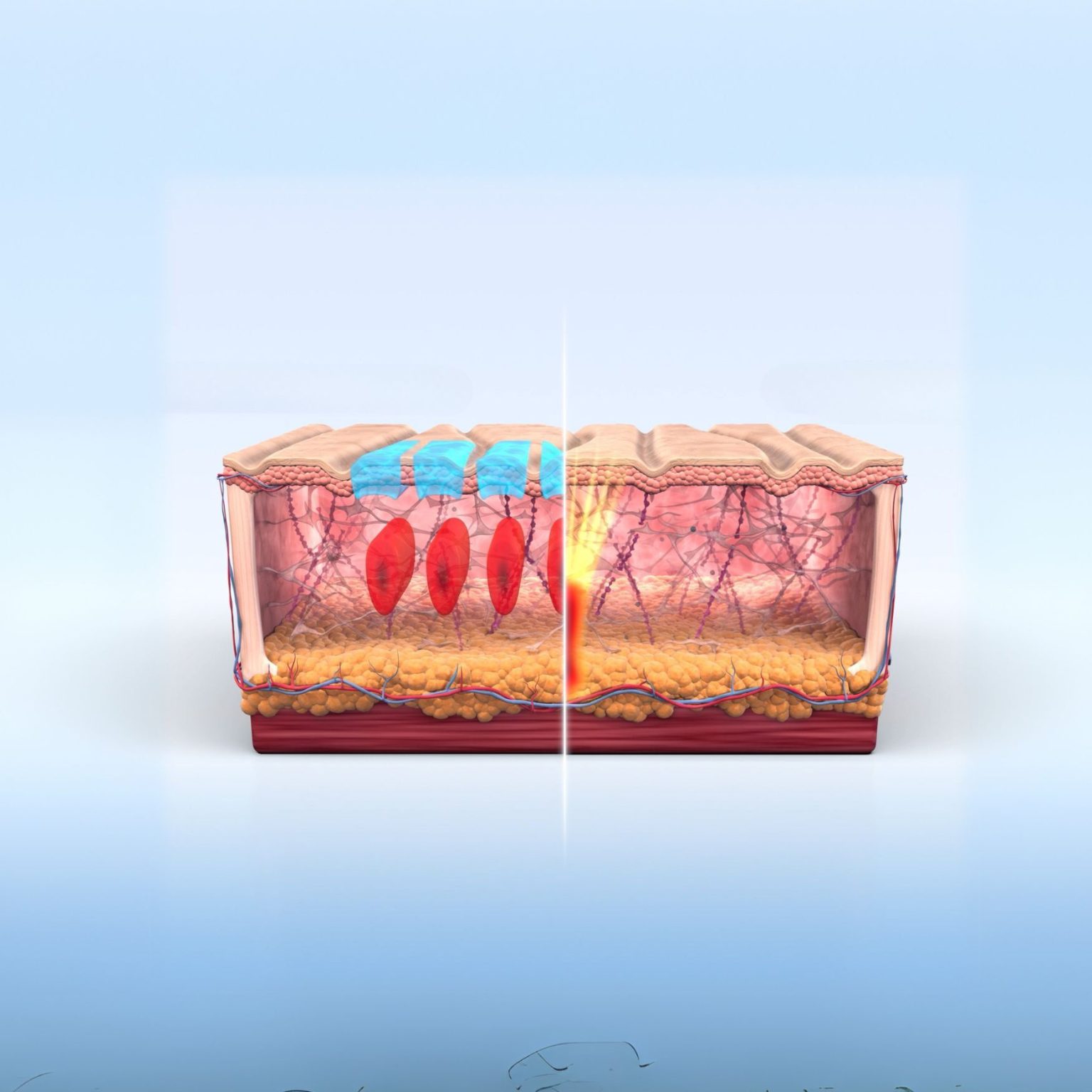 Sofwave™ SUPERB™ Technology