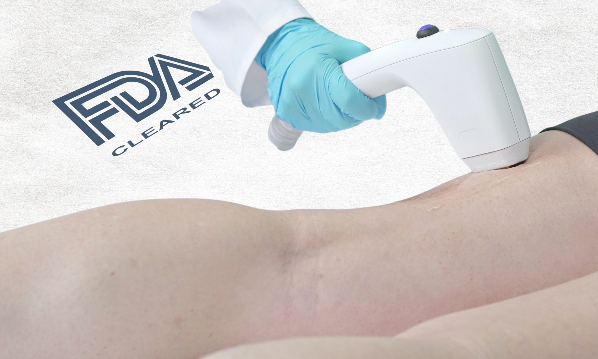 Sofwave Resource Center